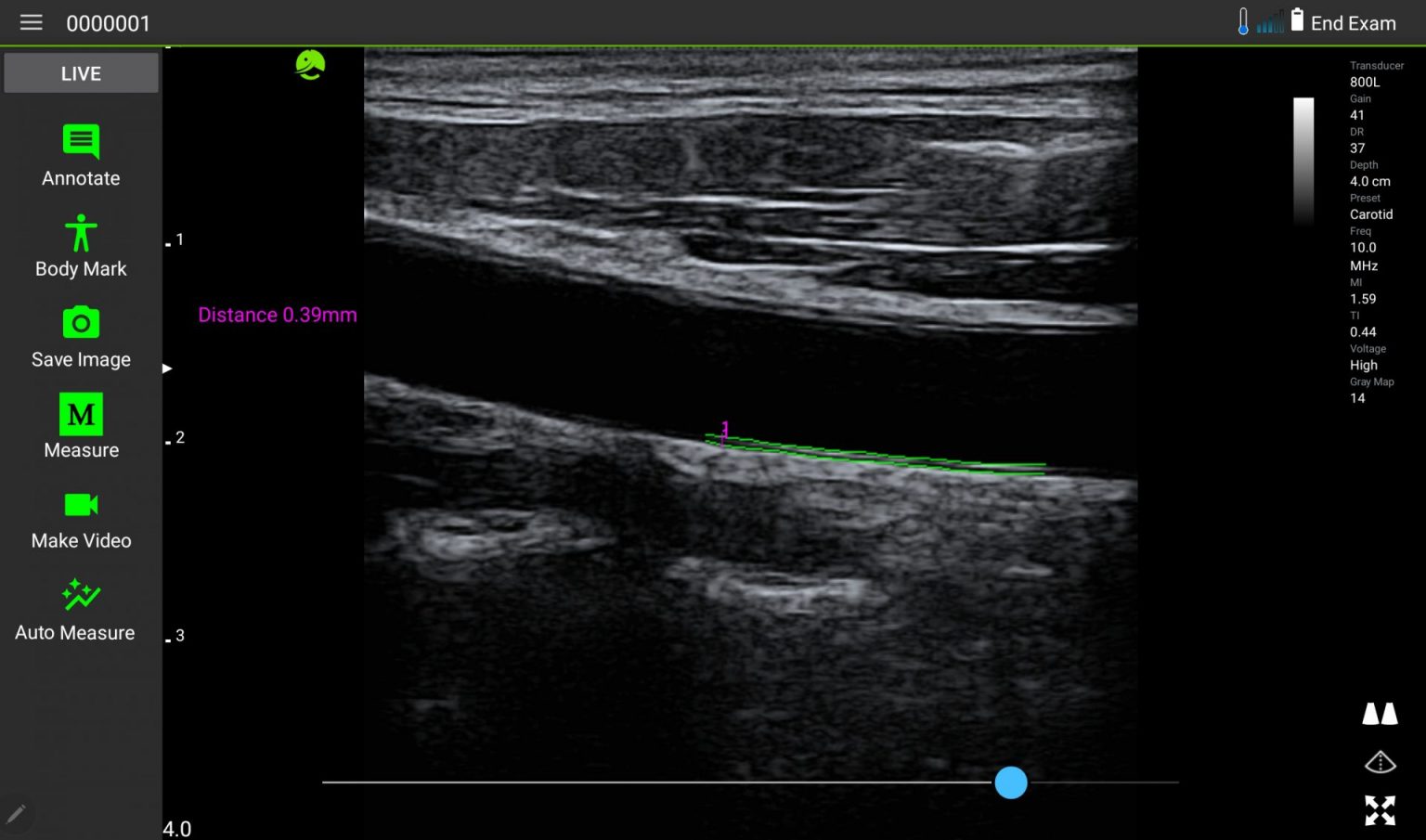 LeSONO Linear Probe – 超象科技